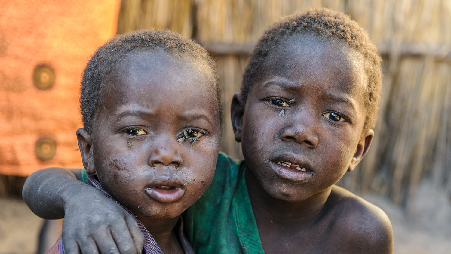 You can help us stop the agony of trachoma | Sightsavers